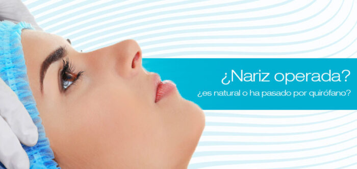 ¿Nariz operada o natural, Dr.? Rinoplastia con resultados naturales